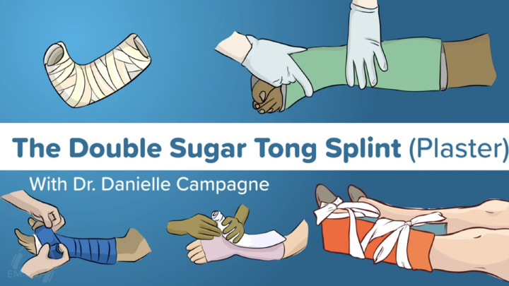 HD - Double Sugar Tong (Plaster) | EM:RAP