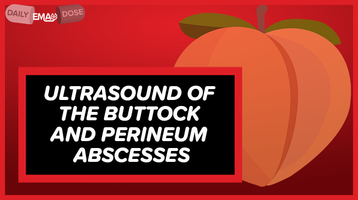 HD - Ultrasound of the Buttock and Perineum Abscesses | EM:RAP
