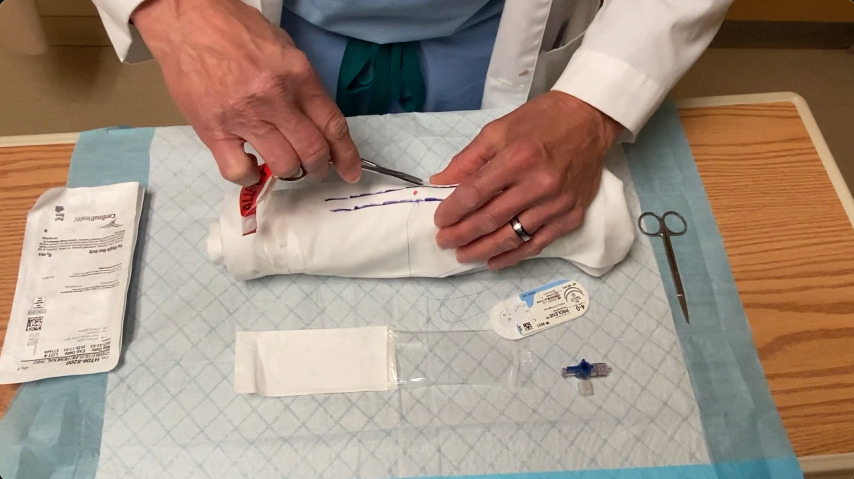 HD - The Woggle Technique: Dialysis Access Repair | EM:RAP