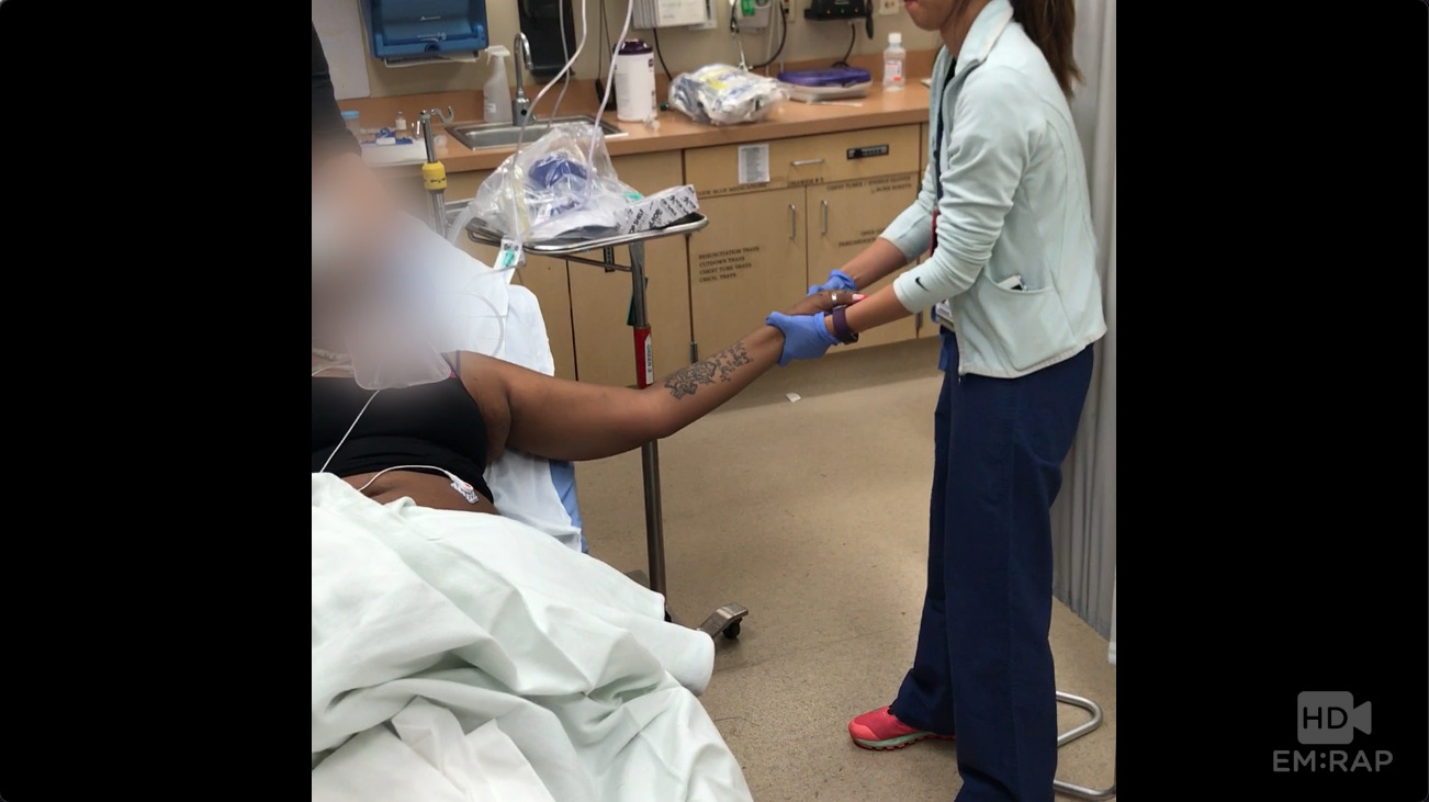 HD - FARES Shoulder Reduction Technique | EM:RAP