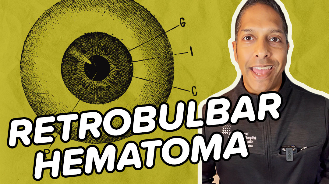Retrobulbar Hematoma