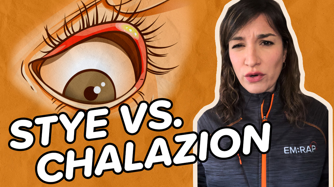 Sty Vs Chalazion Vs Hordeolum